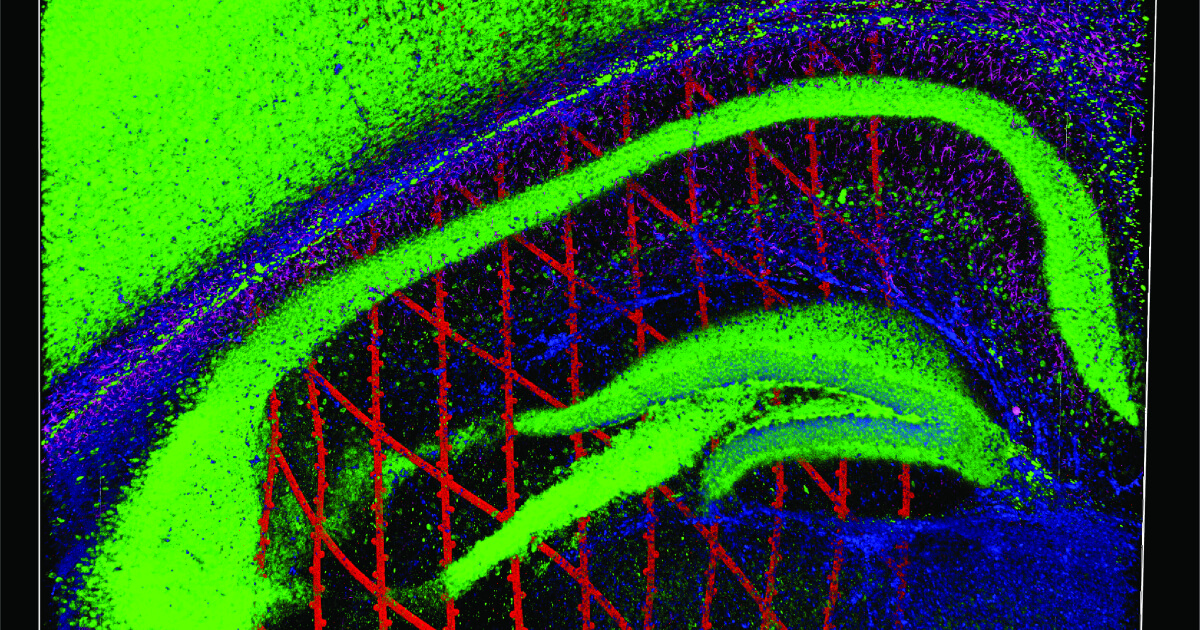 For the first time, it’s possible to record long-term electrical ...